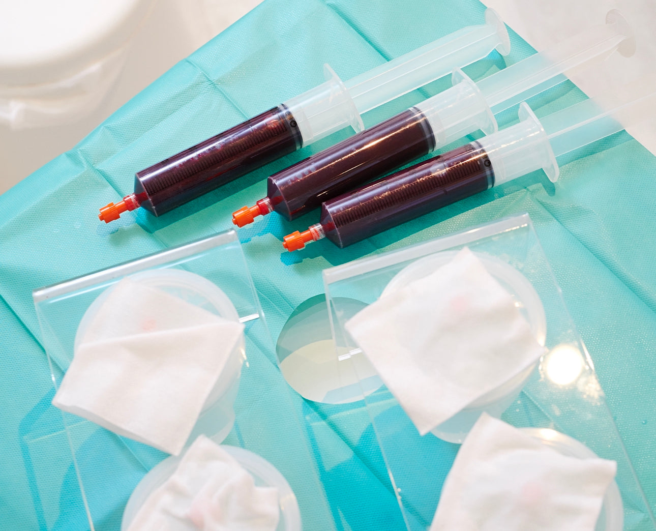 Behandling av håravfall med patientens egna stamceller från blod – 7H Medical